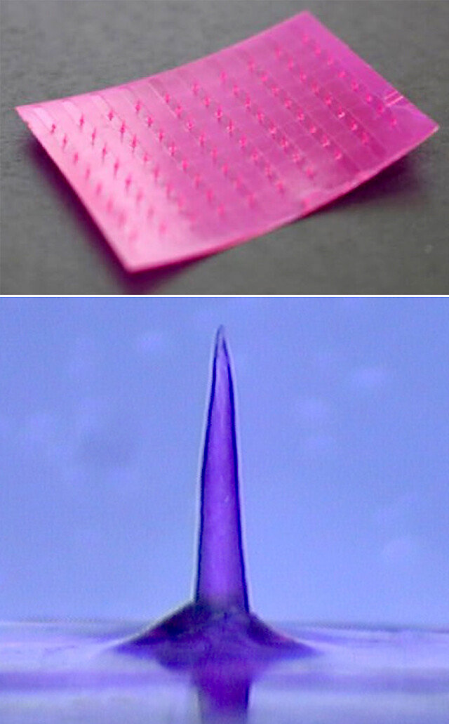 Korean researchers develop the world’s first DNA needle patch | The ...