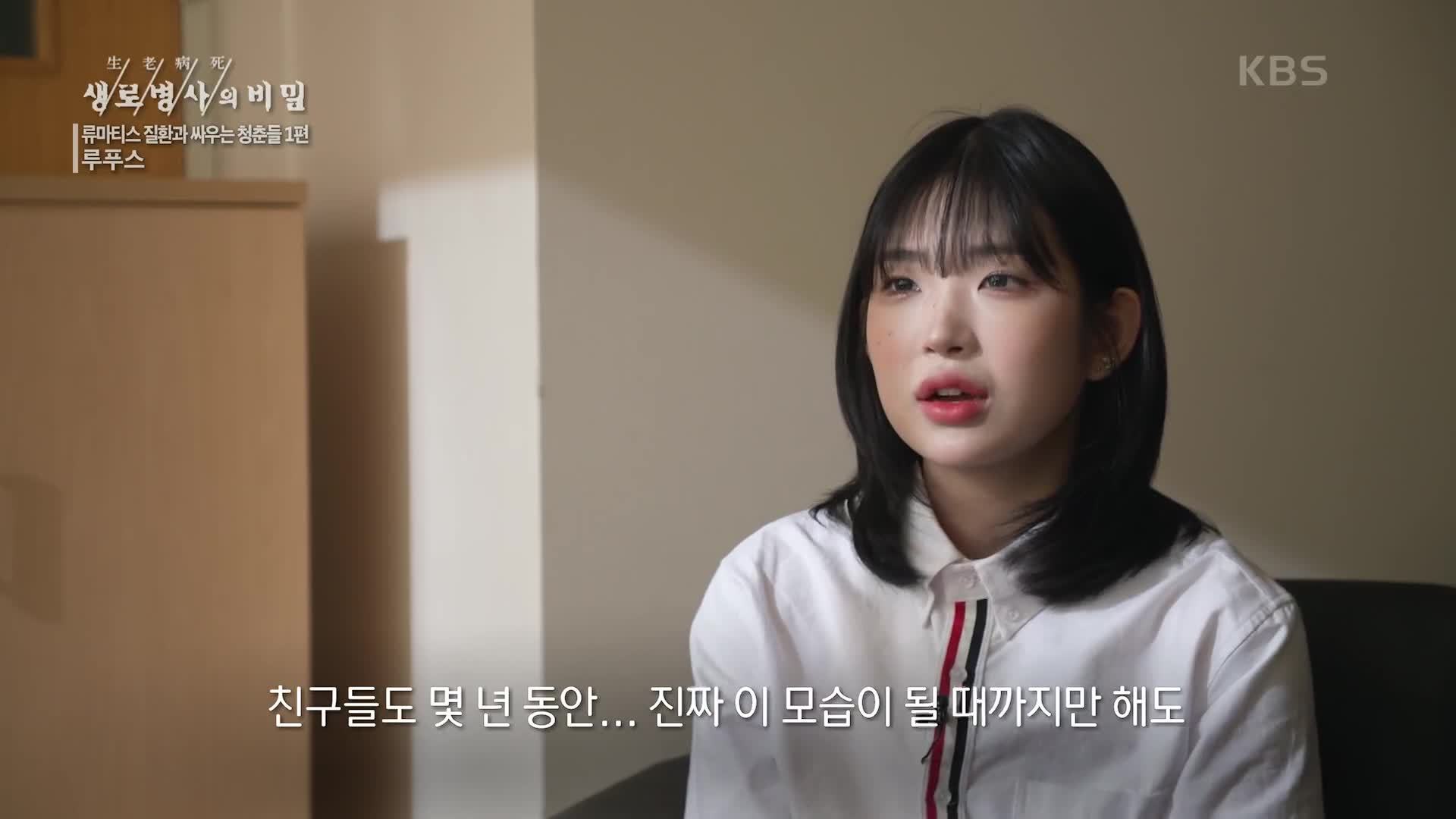 전신을 공격하는 천의 얼굴을 가진 병, 루푸스 | KBS 230315 방송 | 보다