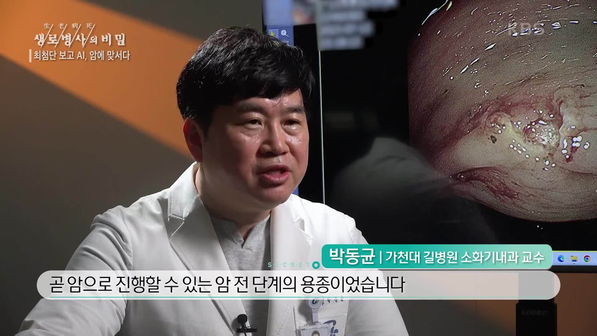 AI로 이겨내는 암, 최첨단 기술로 암에 맞서다 | KBS 230830 방송 | 보다