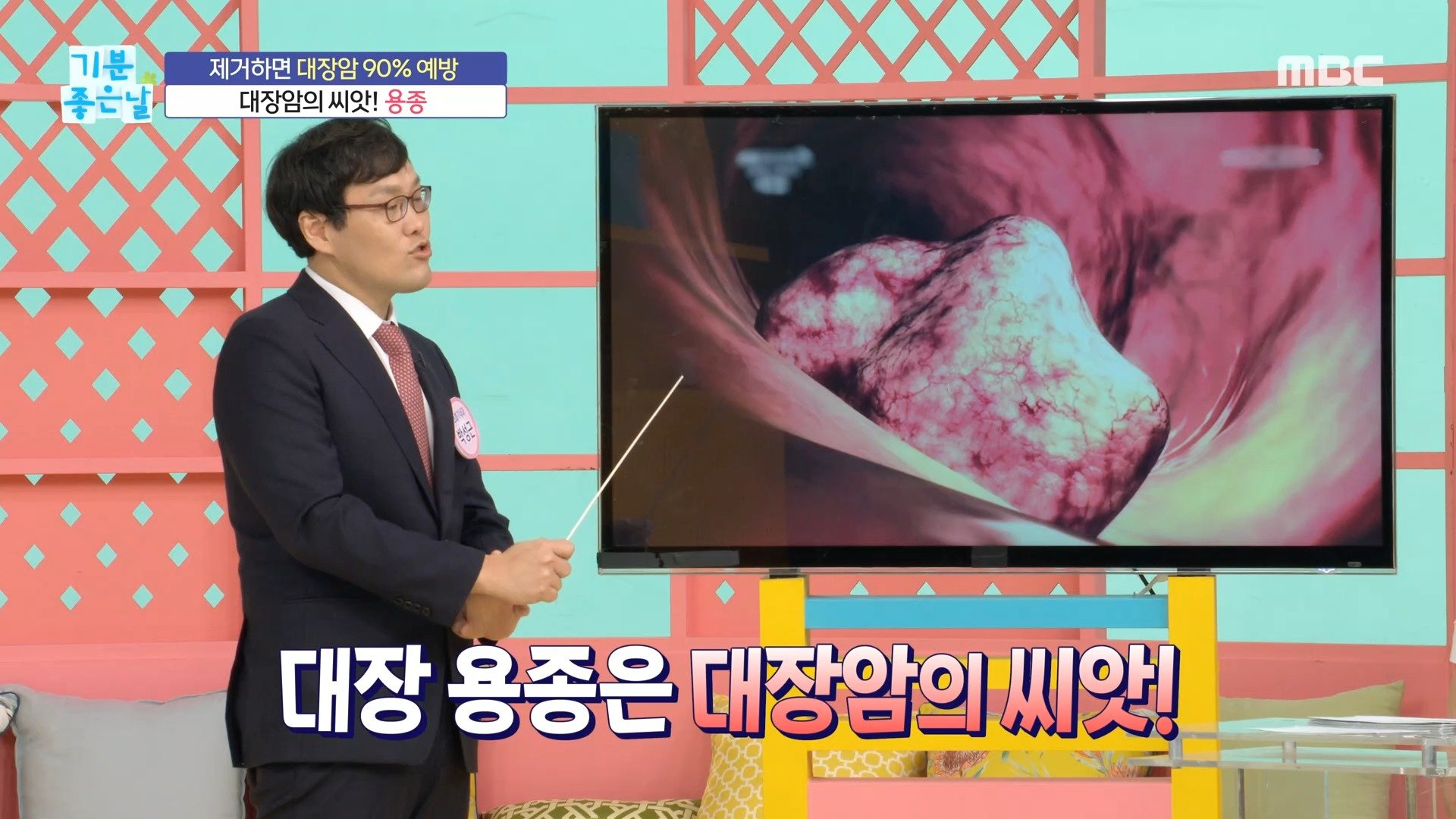 대장 용종은 대장암의 씨앗!, MBC 220902 방송 : VODA